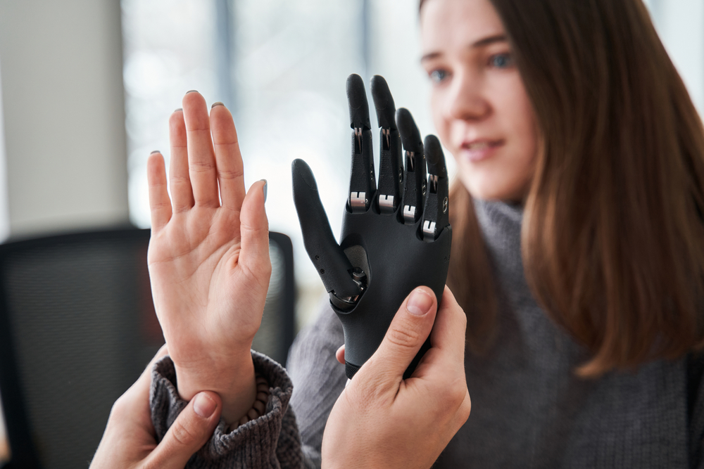 7 Powerful Facts About Prosthetics Transforming Lives Globally ...